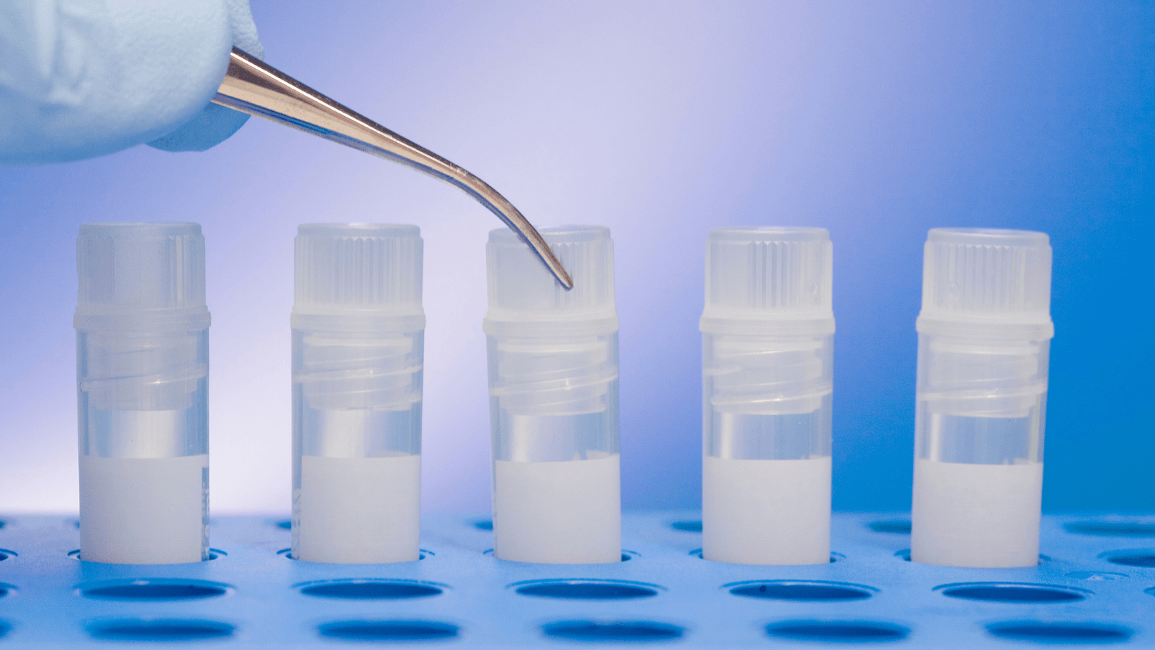 Amniotic Stem Cell Injections for Musculoskeletal Repair