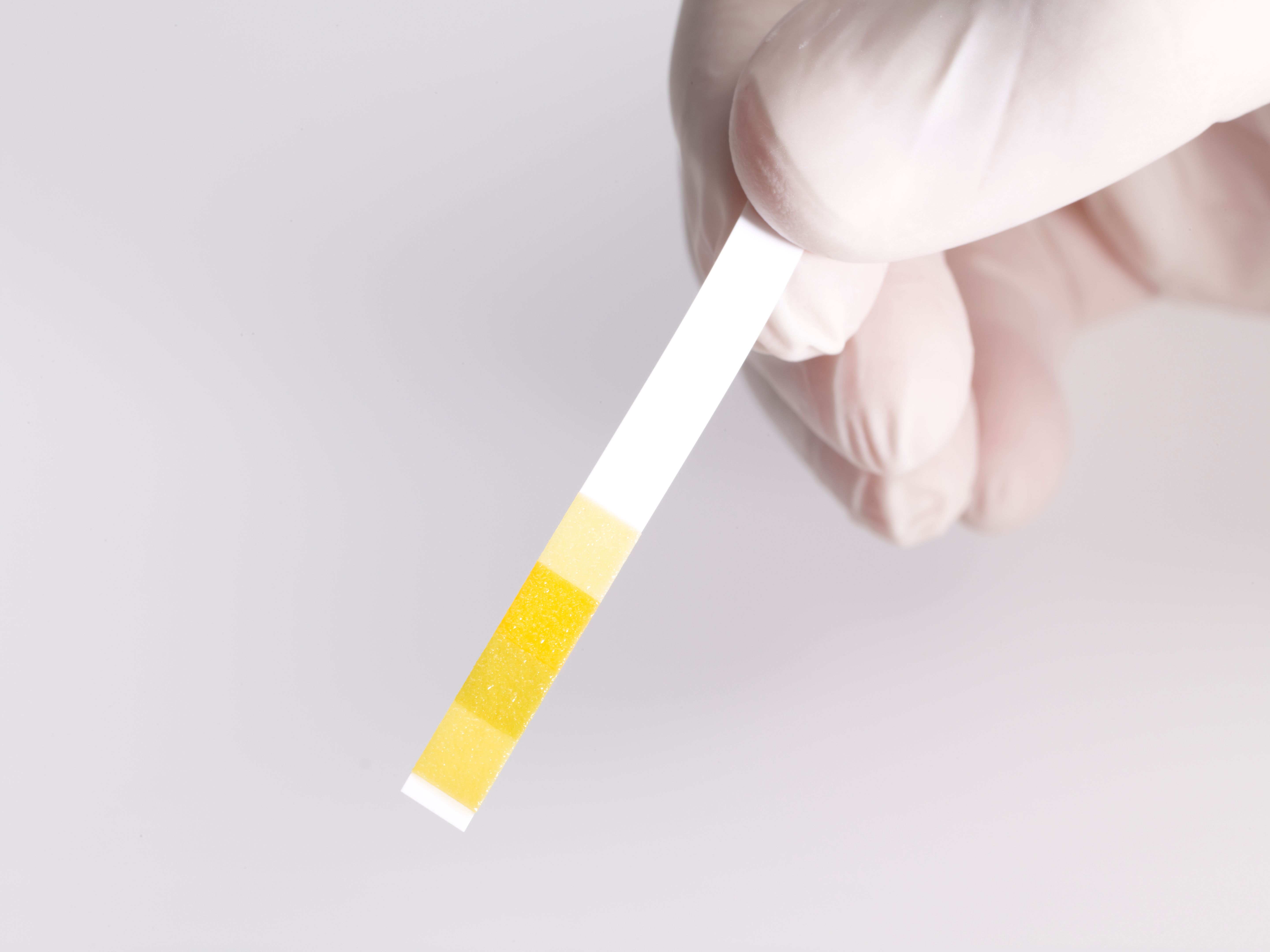 Understanding the Silver Nitrate Test: A Simple Guide