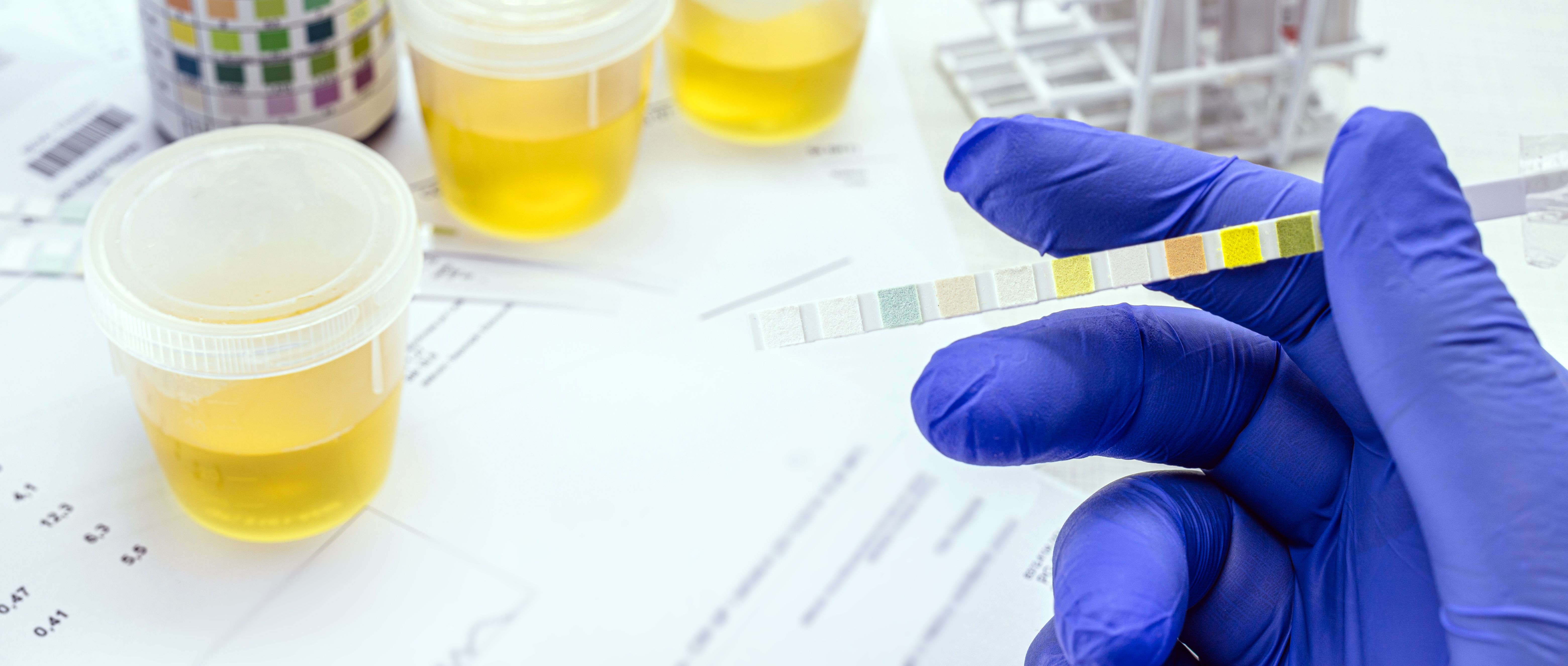 DOT vs Non-DOT Drug Testing: Understanding Your Legal Requirements