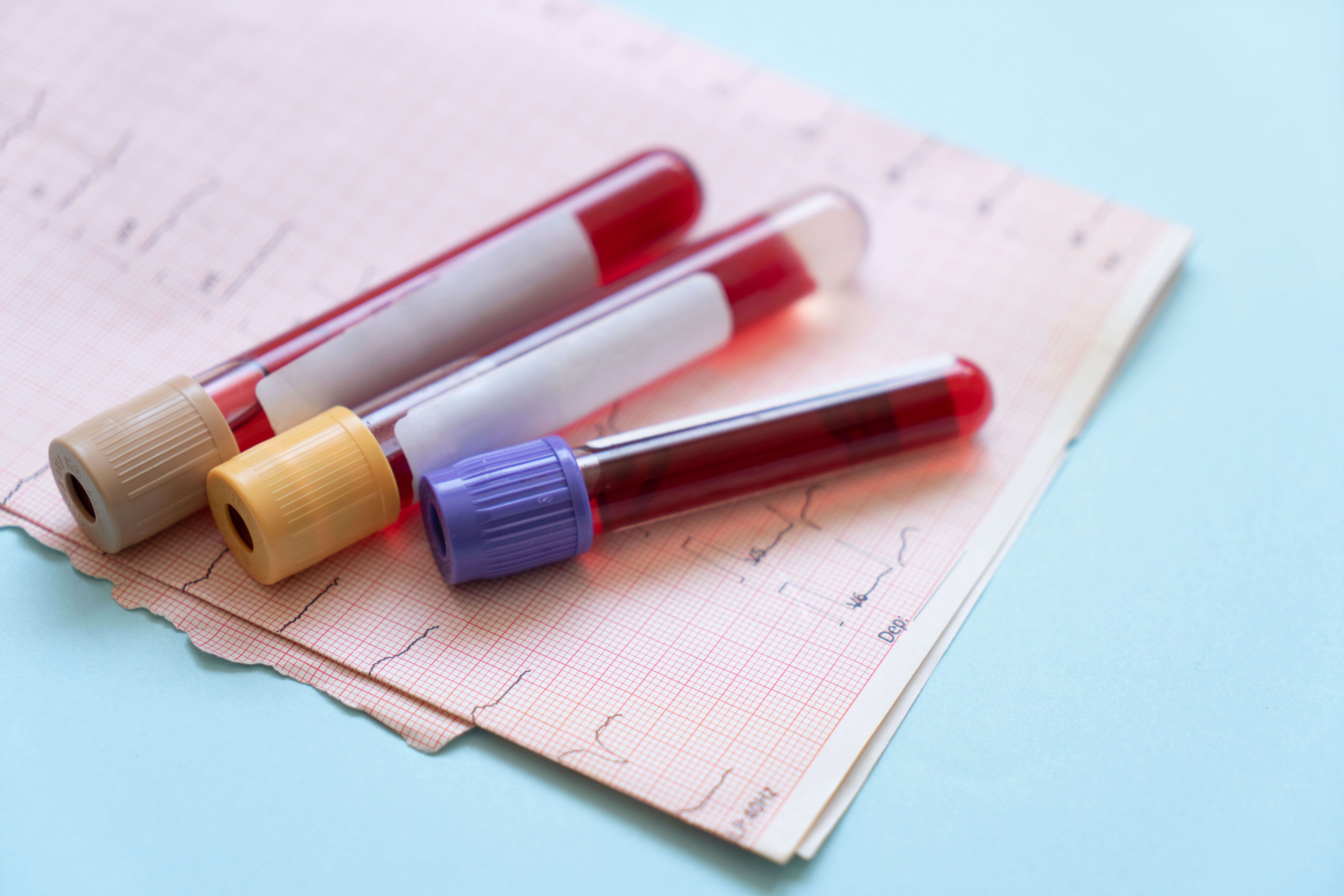 The Importance of Blood Work for Men in Their 40s
