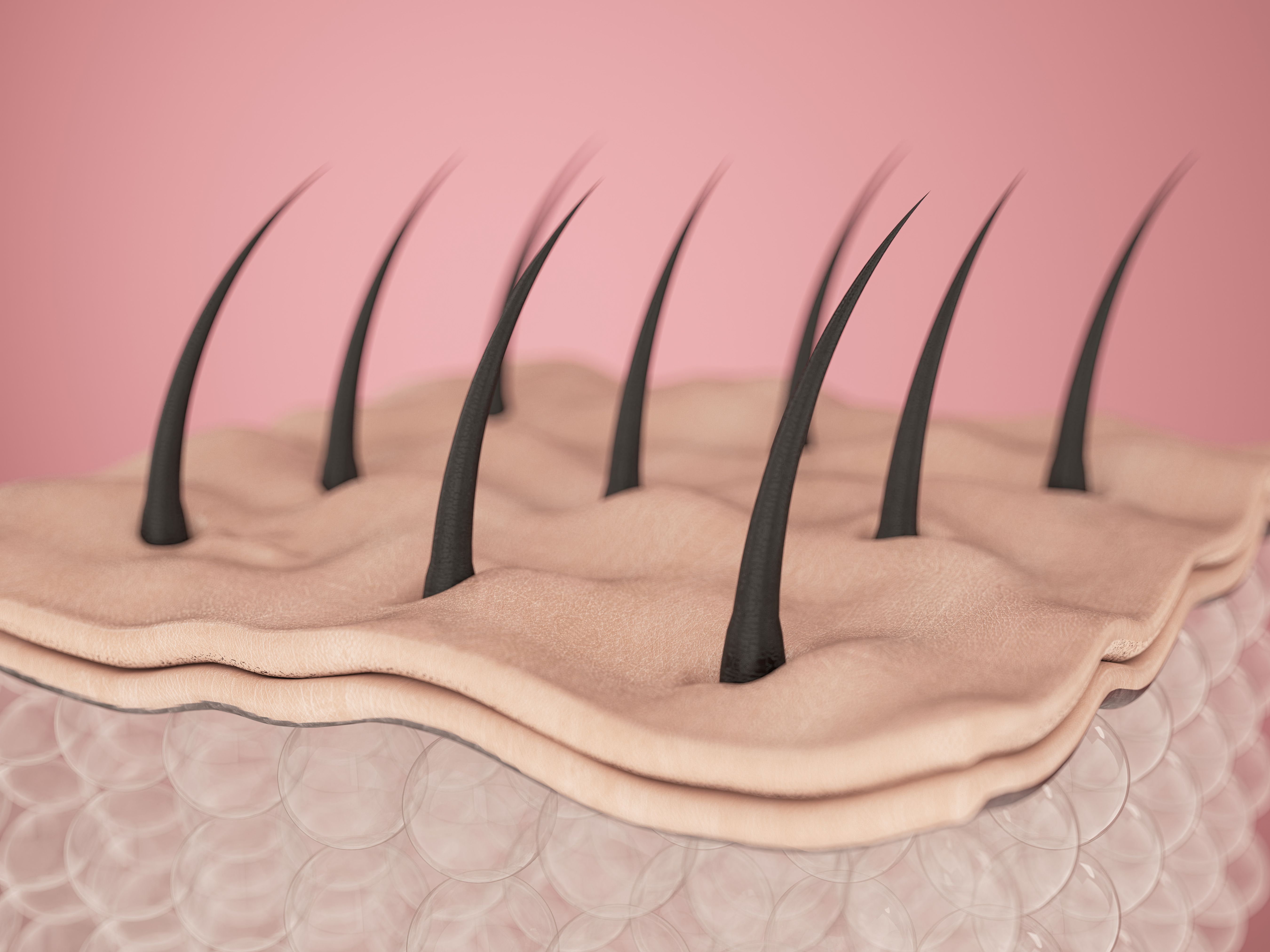 Hair Cloning: The Future of Hair Restoration?