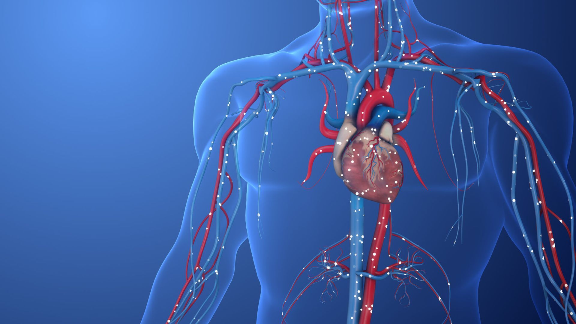 Plaquex IV Infusion Therapy in Oakland Park, FL | Cardiovascular ...