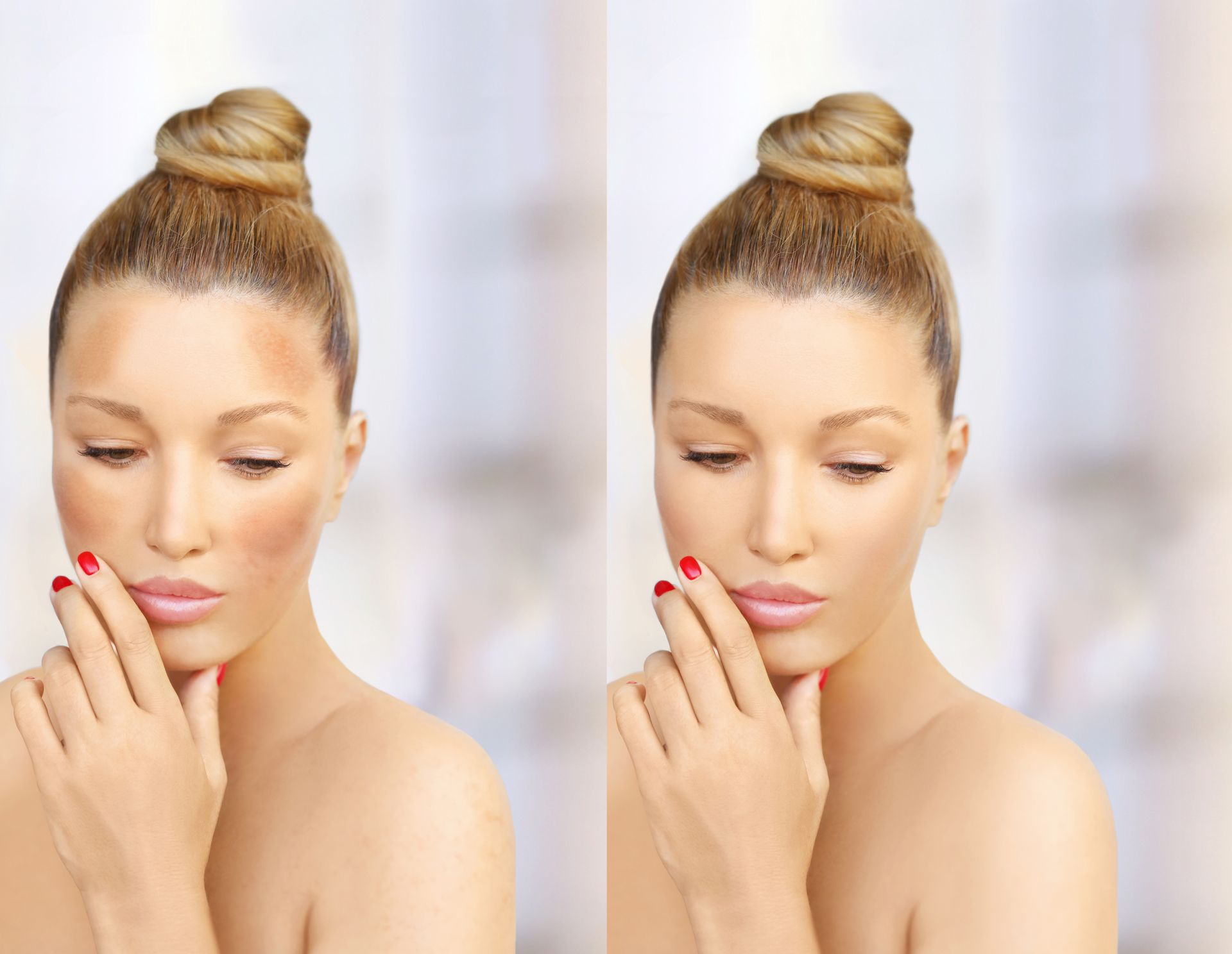 PETE PIGMENTARE – CAUZELE APARIȚIEI ȘI CUM POȚI TRATA PETELE MARONII DE ...