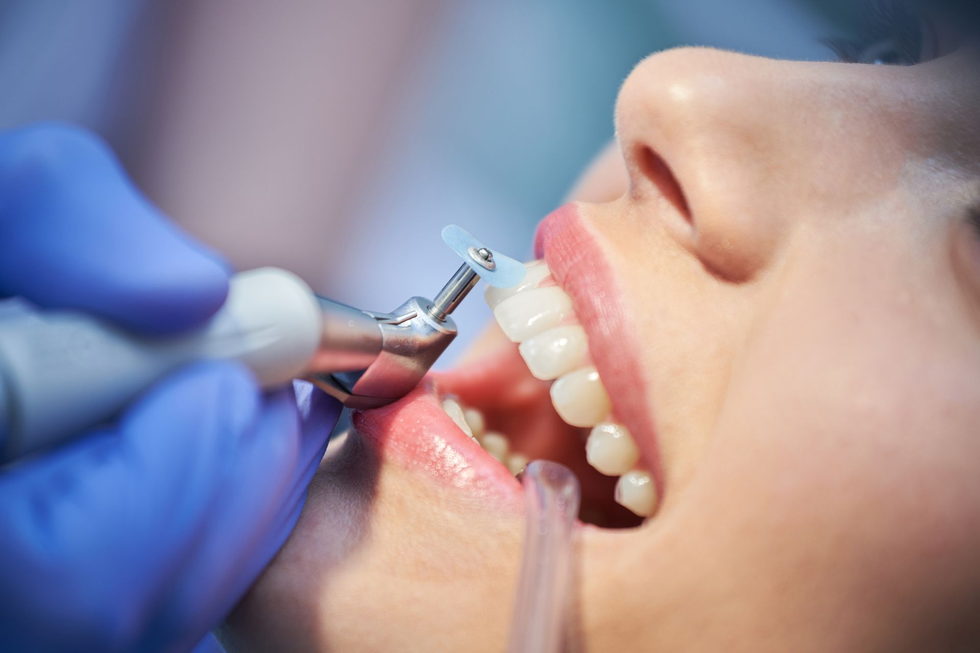 The Hidden Dangers of Mercury in Dental Amalgam Fillings